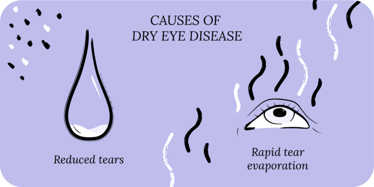 What is eyelid hygiene? - CorneaCare | Eyecare Made Easy