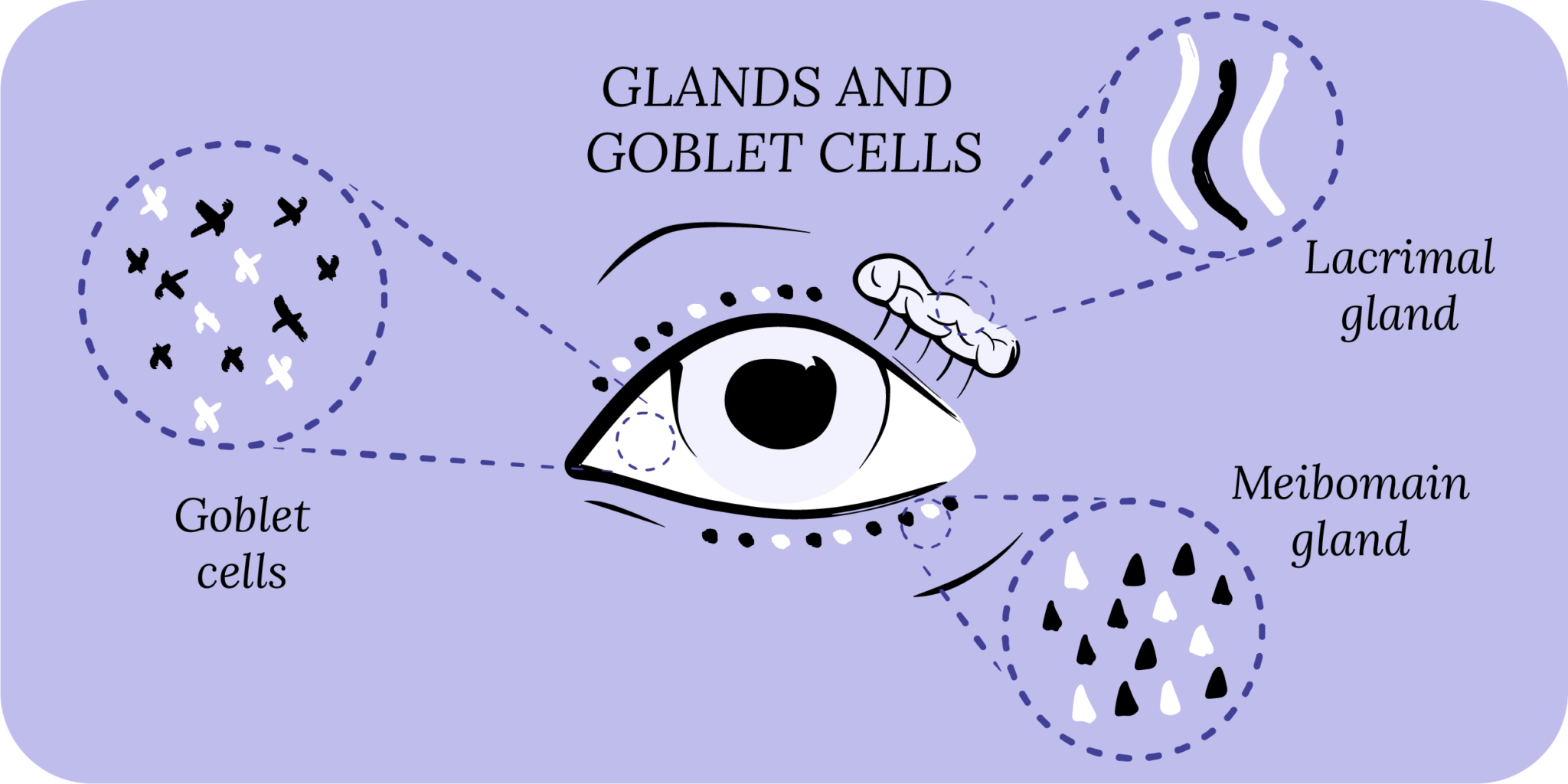 Alternatives to Expressing Meibomian Glands - CorneaCare