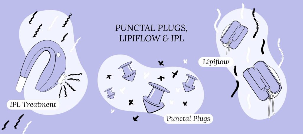 Punctal Plugs, LipiFlow, IPL, Oh My… - CorneaCare