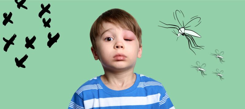 What to Do If You Get a Mosquito Bite on Eyelid - CorneaCare