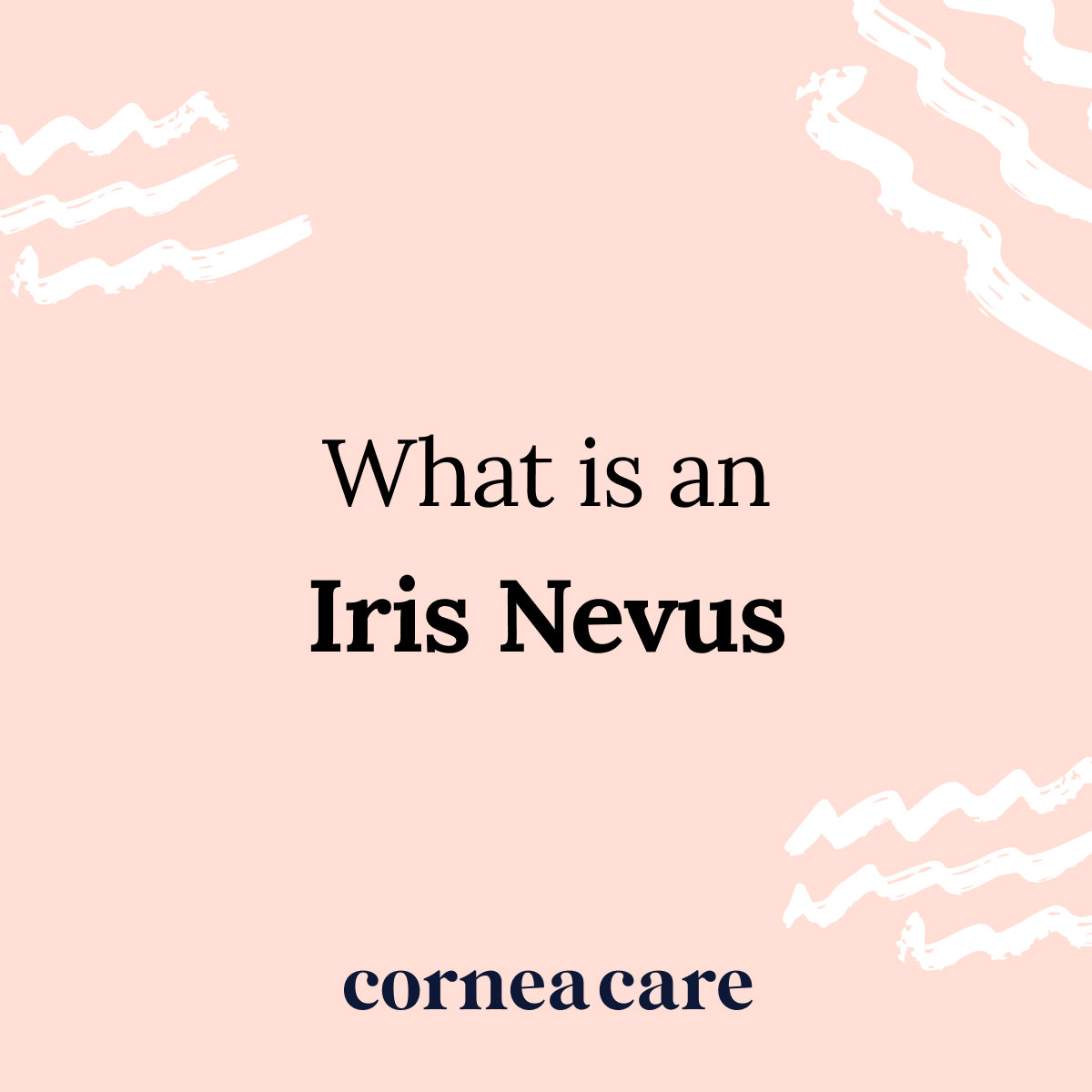 Iris Nevus - CorneaCare
